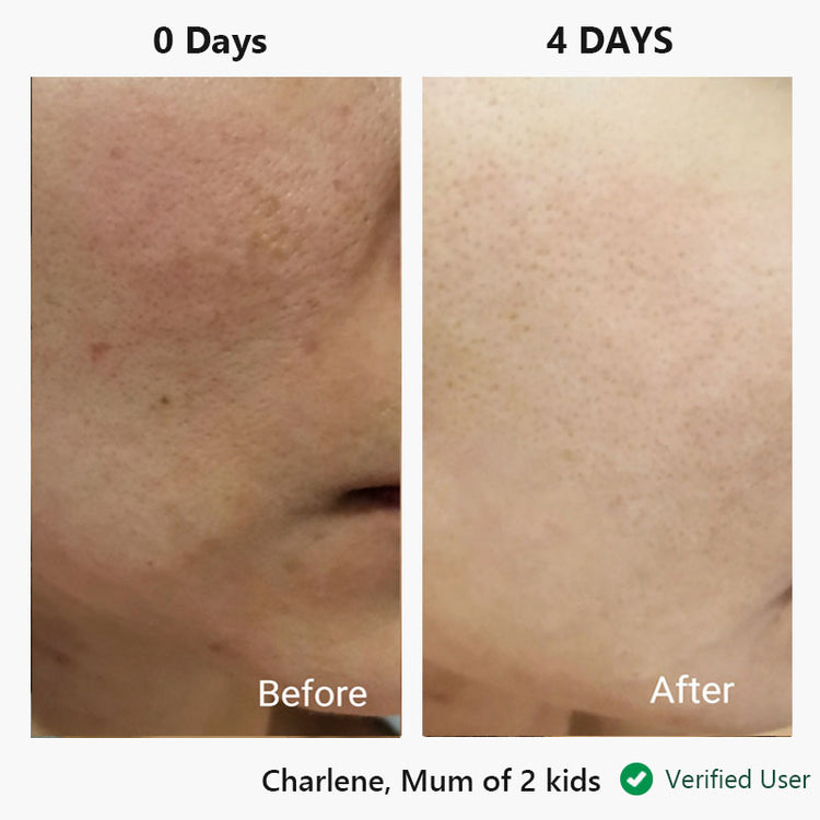 nor sken | World's 1st Reverse-ageing Vegan Cream – nor sken global